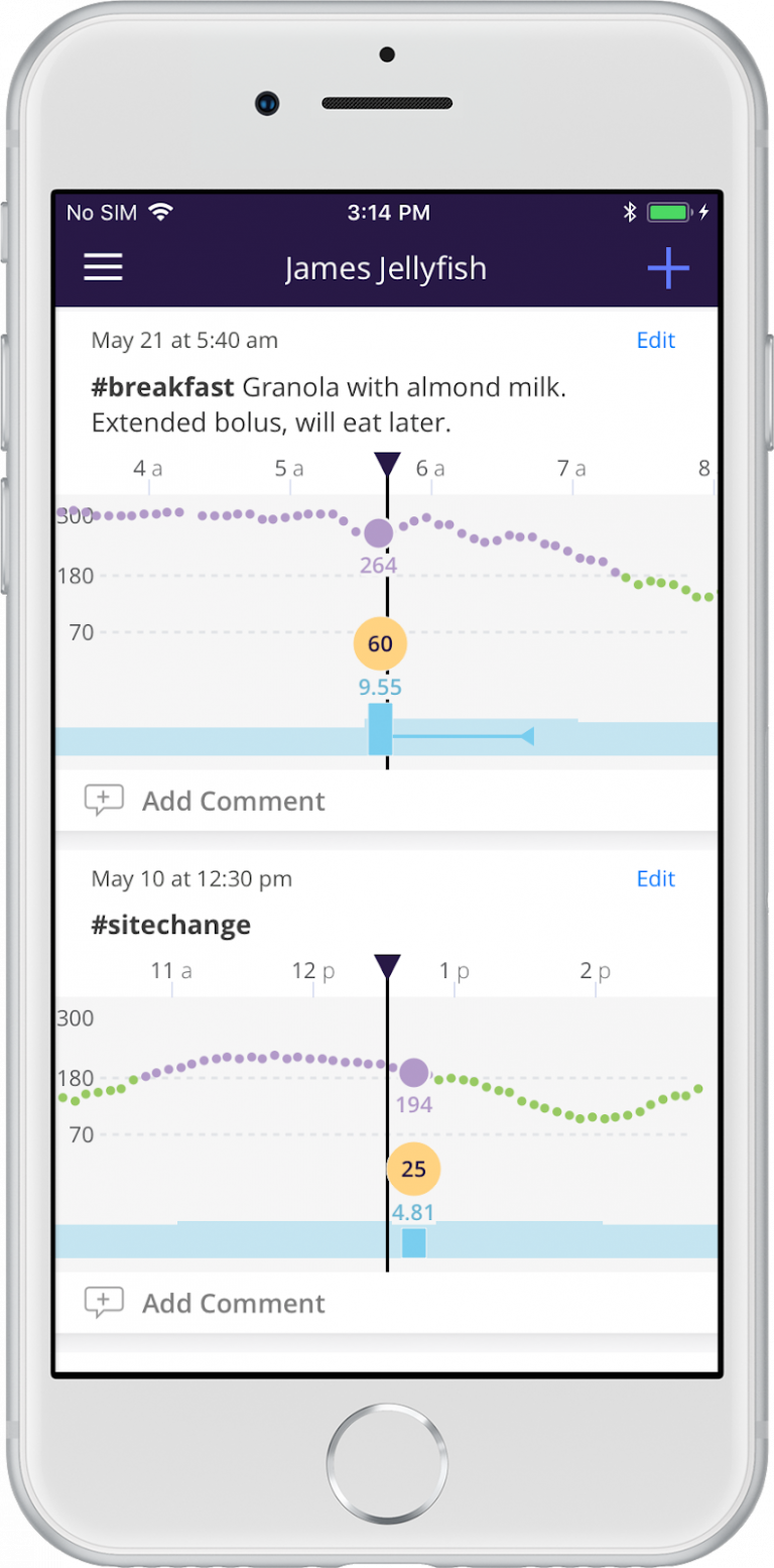 Yes, you should share your CGM & Pump data with Tidepool - Insulin Nation