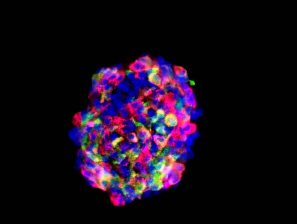 Seraxis Islet Technology Aims for Practical T1D Cure - Insulin Nation