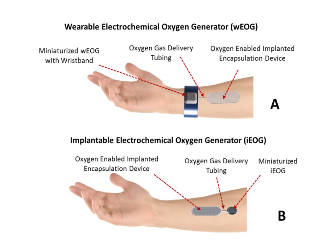 Oxygen Critical to Practical Islet Transplants | Insulin Nation