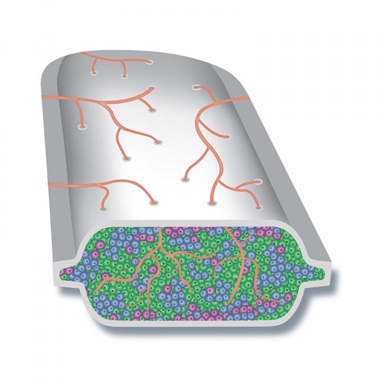 Will ViaCyte’s Encaptra Cell Delivery System ‘Cure’ Type 1 Diabetes ...